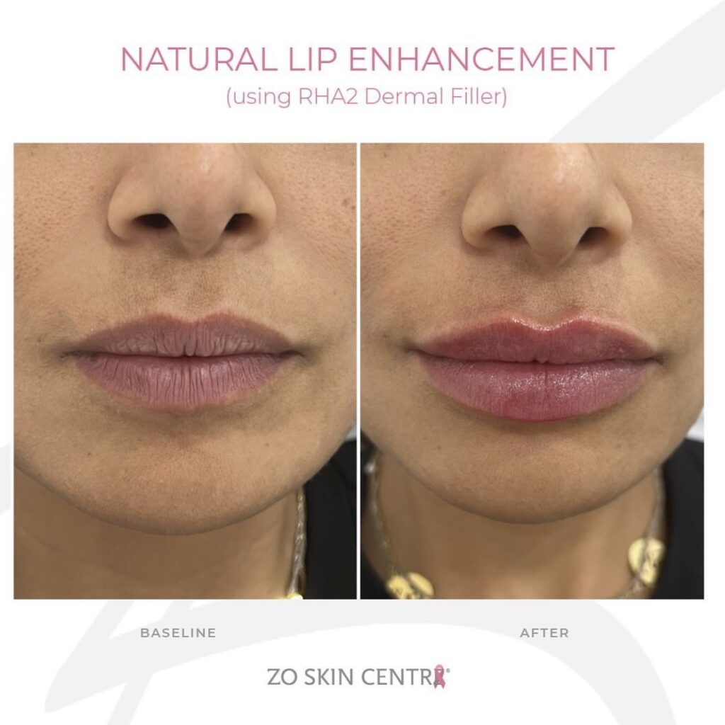Achieve Plumped Lips at One Of These Professional Clinics – Cairo 360 ...